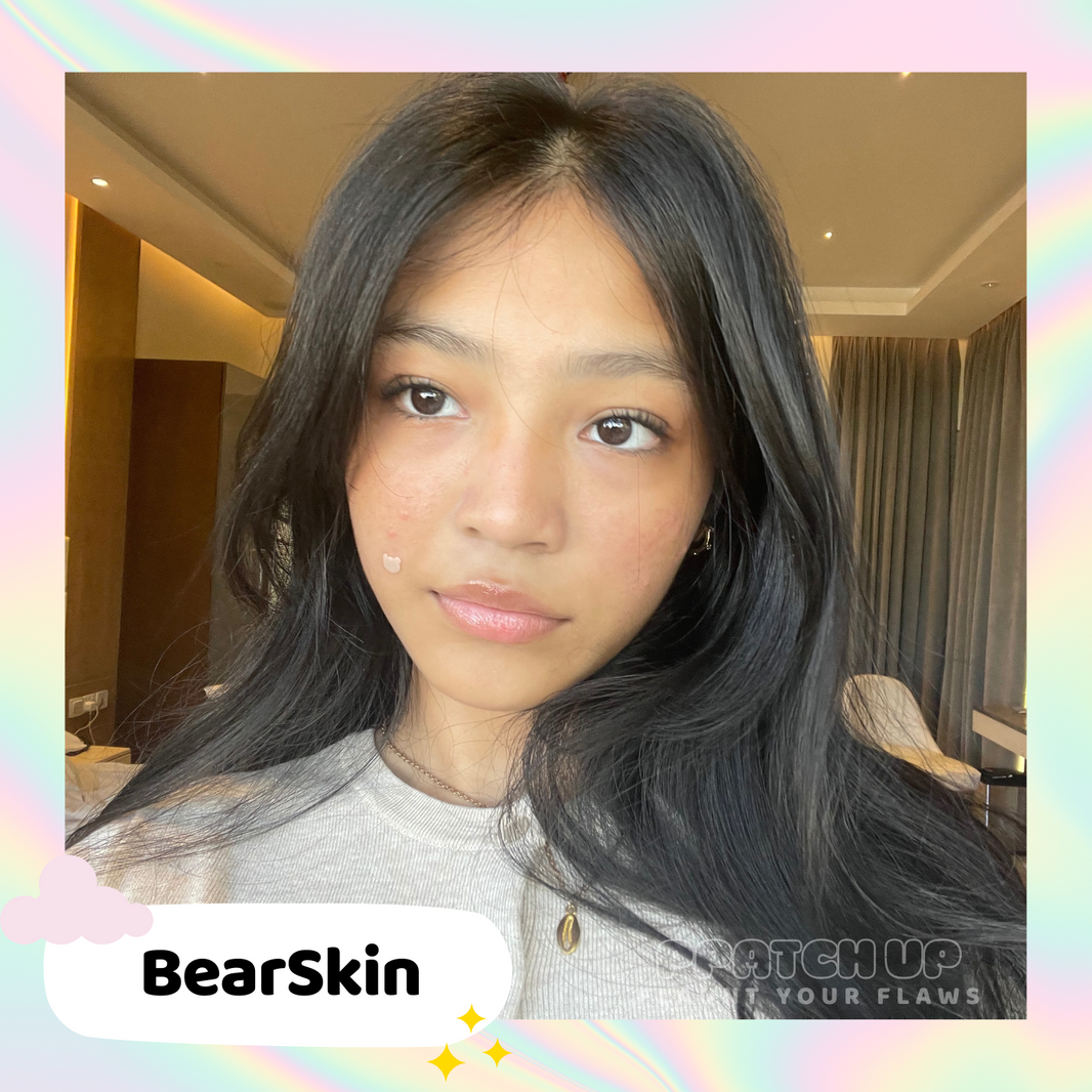 Products – Ppatch Up